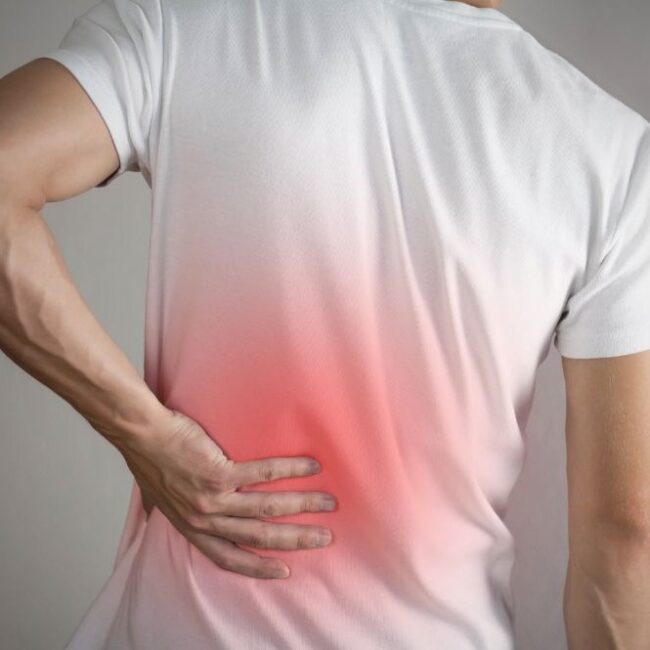 Akupunktur untuk Sciatica: Cara Aman Meredakan Nyeri Menjalar dari ...
